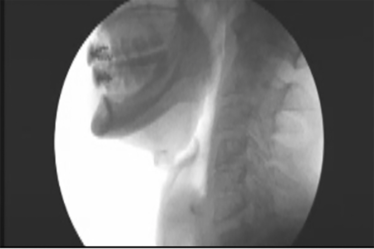 Future Speech-Language Pathologists Demonstrate Research at CSD ...